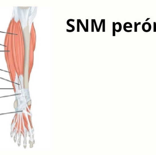 SNM peróneo