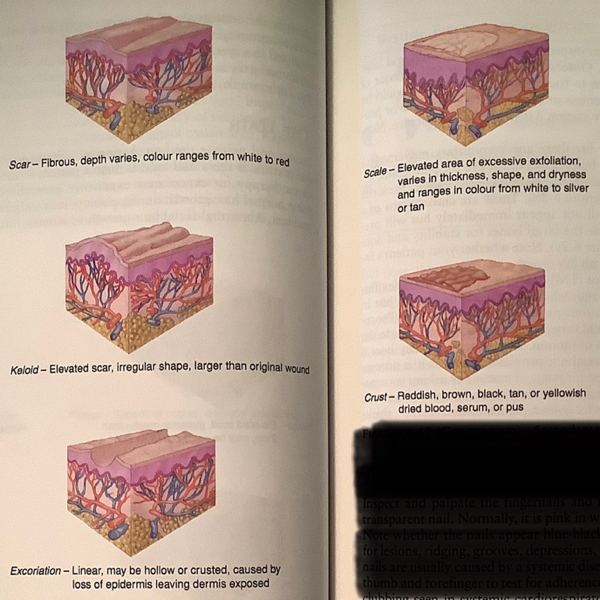 Secondary skin lesions