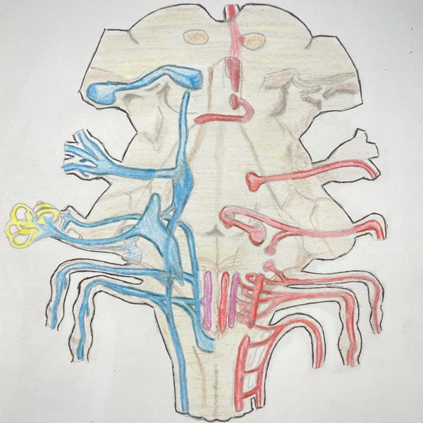 Fosa Romboidea Núcleos de Nervios craneales