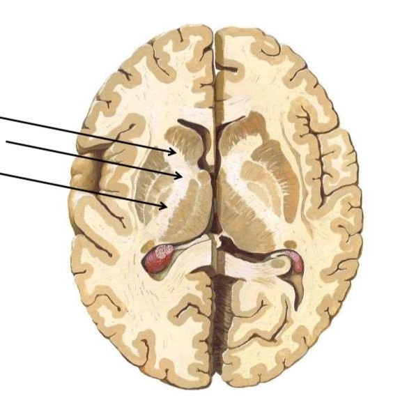 Partes cápsula interna
