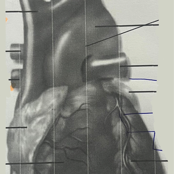 Lamina anatómica morfología externa del corazón, cara anterior
