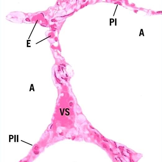 Histología de los alveolos