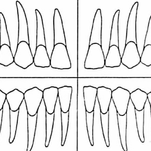 Haderup Nomenclatura dental
